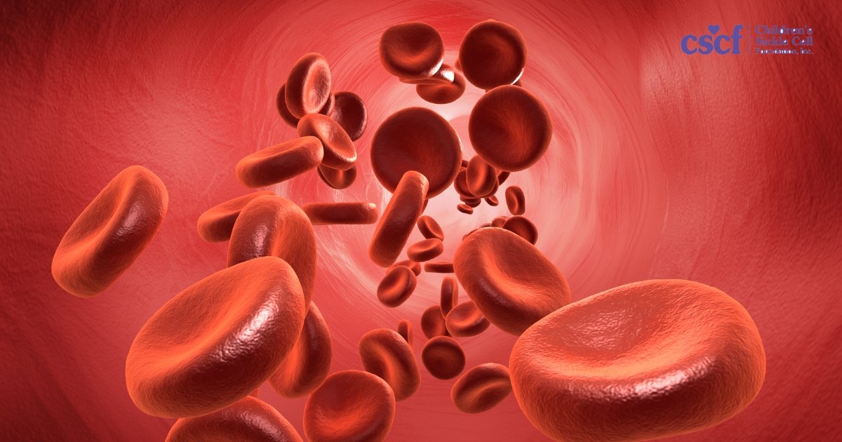 The Most Crucial Children Sickle Cell Disease Facts to Know